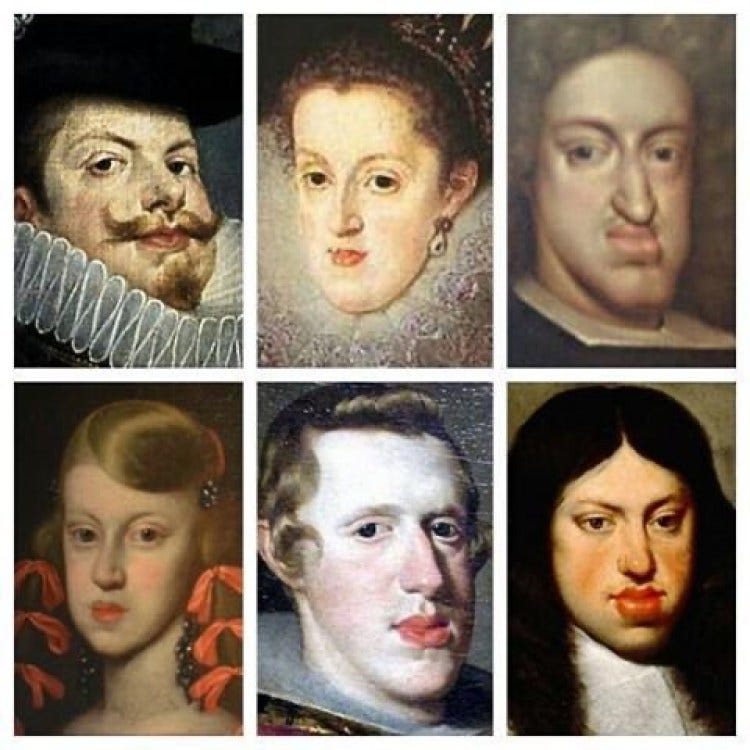 Habsburg Jaw Celebrities 60 Photos - Moonagedaydream.film