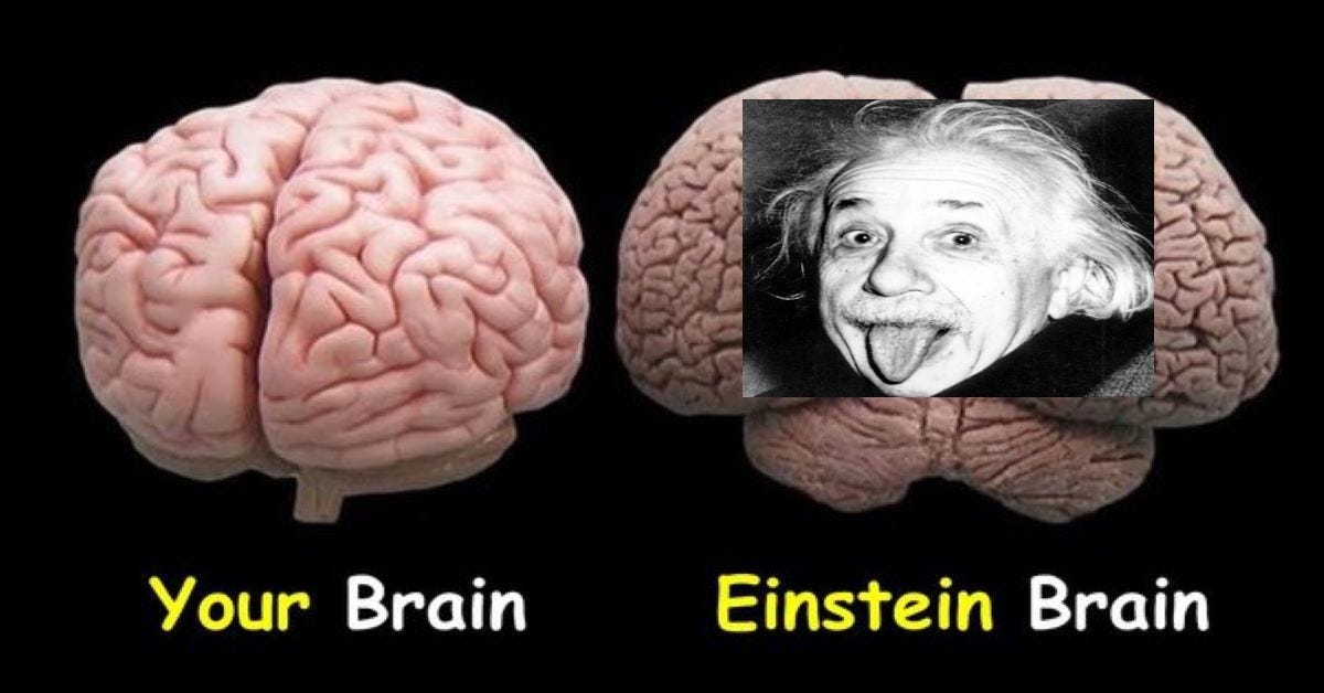 Albert Einsteins Brain Compared Average Brain