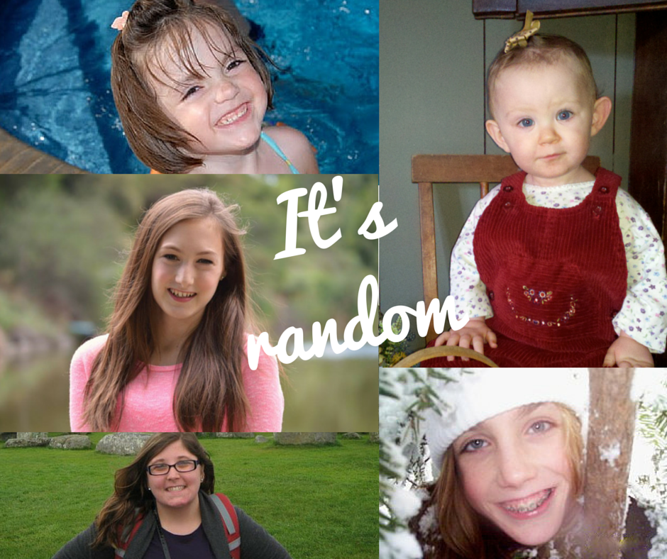 What Do Babies With Turner Syndrome Look Like