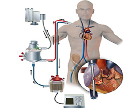 Ecmo Pump Parts