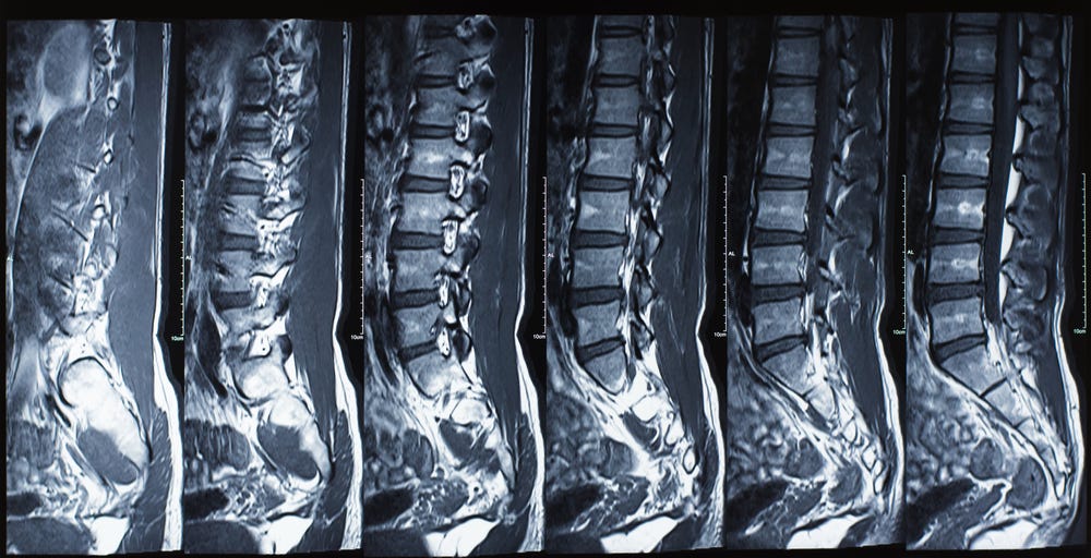 Tips for Finding a Great Spine Surgeon | by Michael Sinel M.D | Medium