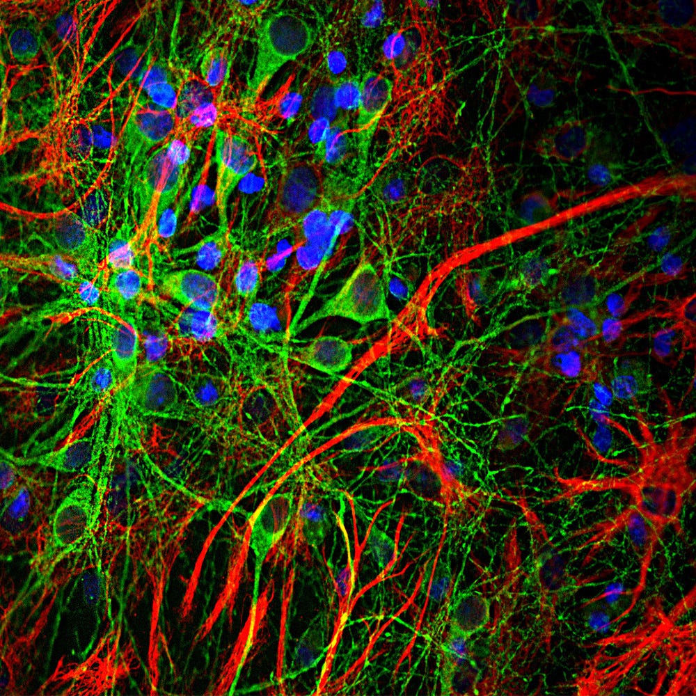 Spinal cord neurons create a pain gateway | by Patrick Flynn | Bite ...