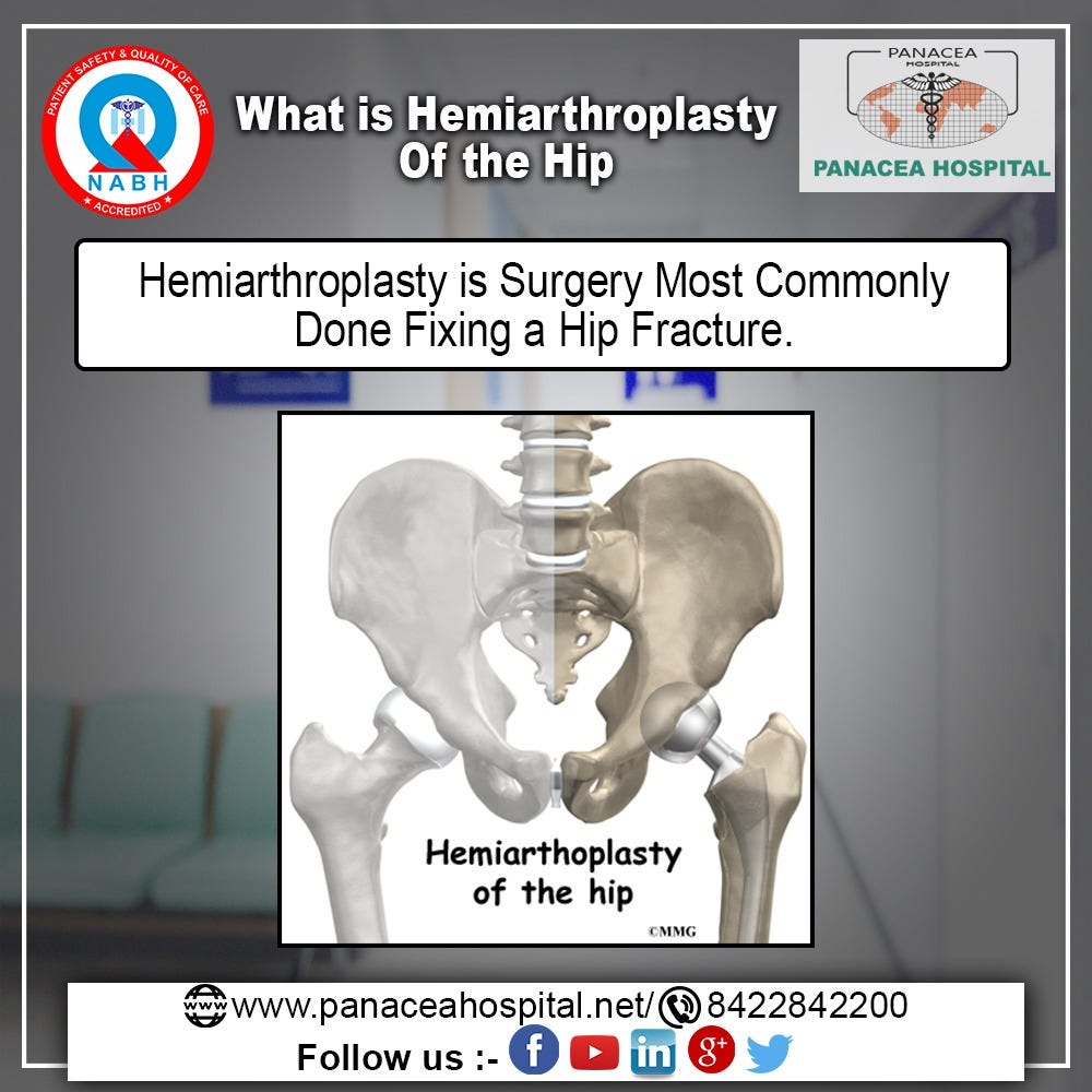 WHAT IS HEMIARTHROPLASTY OF THE HIP | by Panacea Hospital | Medium