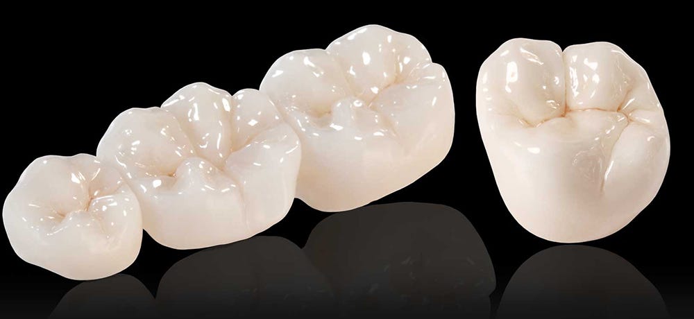 Porcelain crowns are providing strength and resilience to your tooth ...