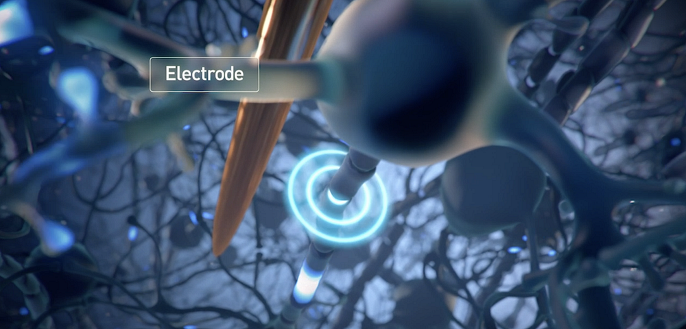 Neuralink. the future of humAnIty | by Victor S | Oct, 2021 | Medium