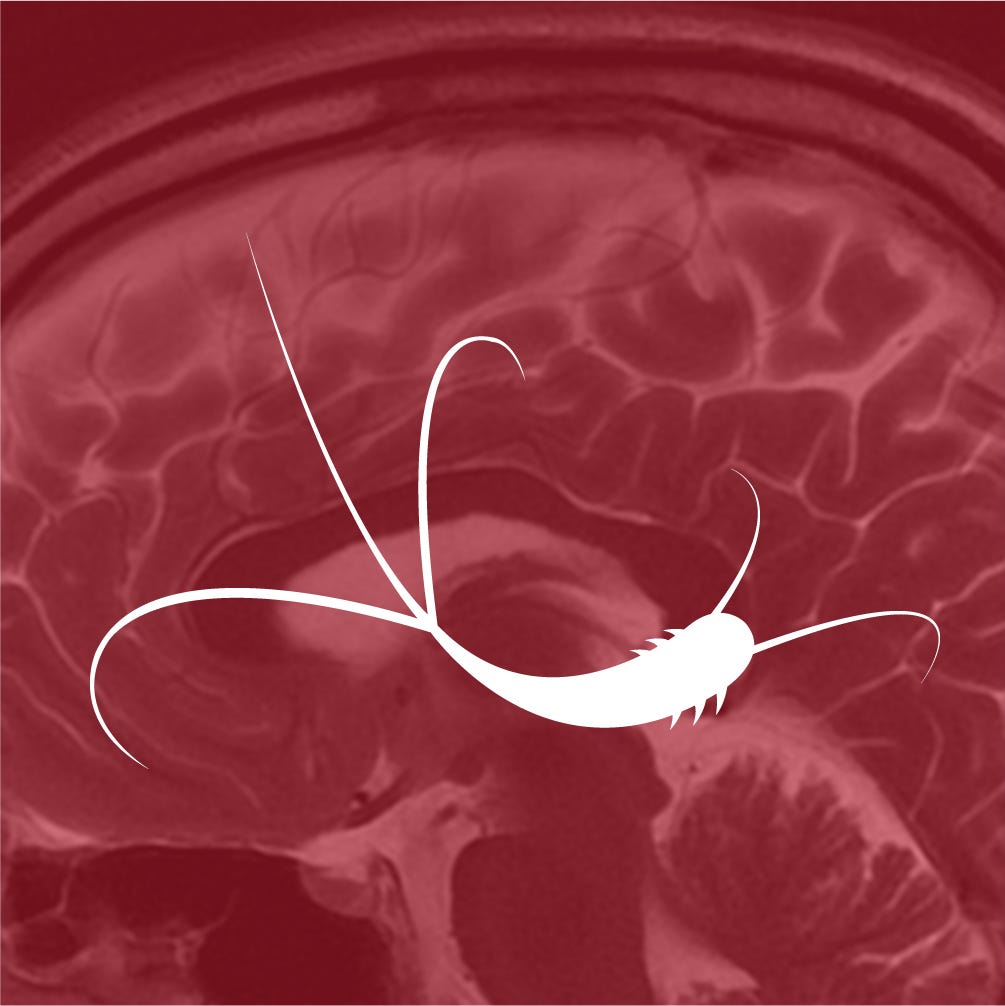 Paroxysms
