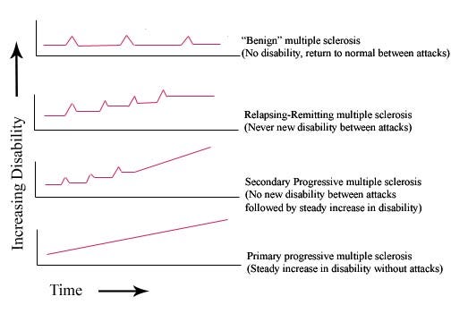 Multiple sclerosis. Multiple sclerosis (MS), the most… | by TheraspOT ...