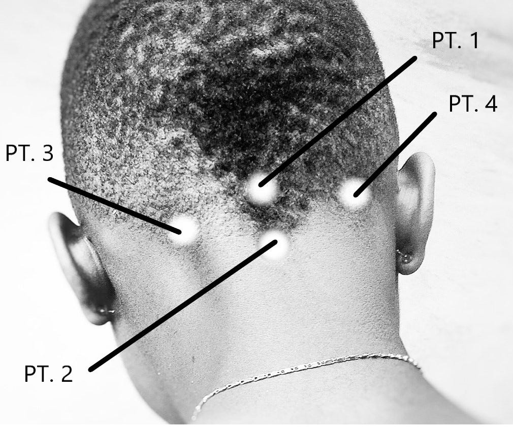 4 Points For Headache Relief. One of the most common complaints… | by ...