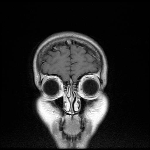 (02): Ghosts In The MRI Machine. by Flat Albert | by Drugs Are Boring ...