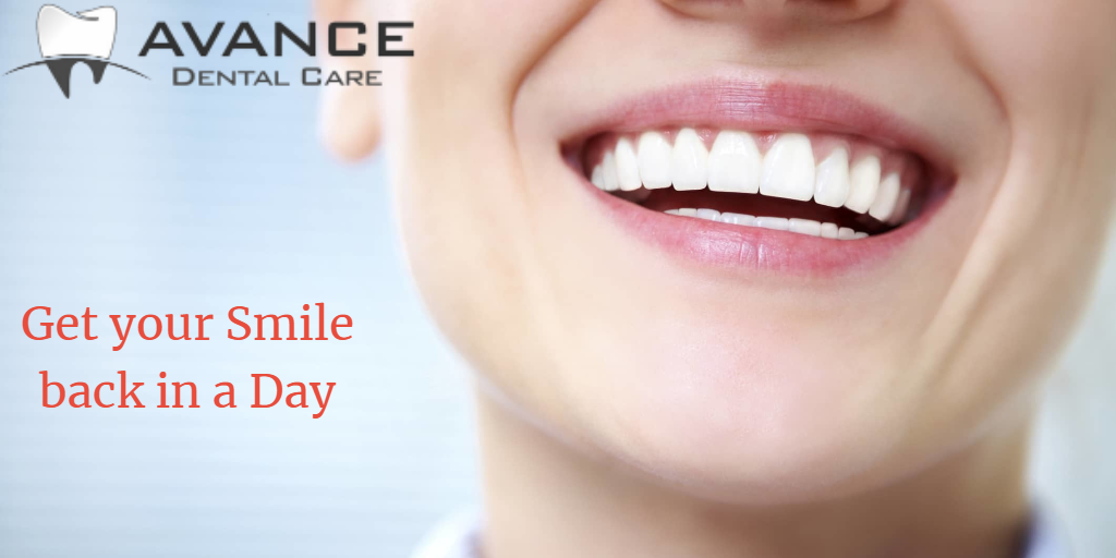 Get your Smile back in a Day. There are many factors to be taken into ...