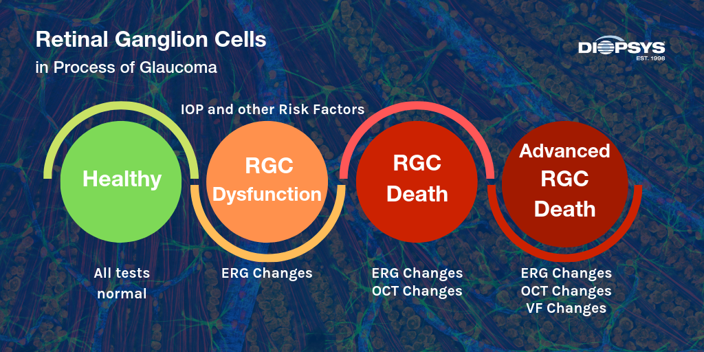 Prevent Retinal Ganglion Cell Death: Detect and Treat Glaucoma Early ...