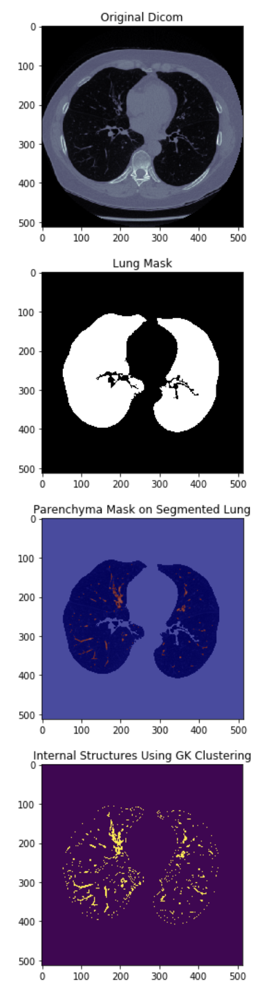 voz compromiso arrojar polvo en los ojos display dicom image python ...