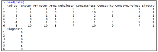 Mengenal Machine Learning I. Support Vector Machine | by Putri ...