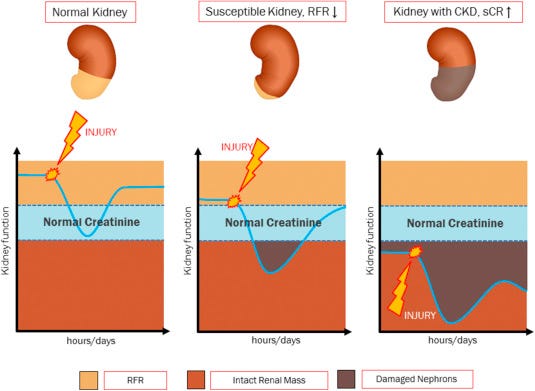 Dr. Azra Bihorac, MD, MS, on How Acute Kidney Injury Should Be Treated ...