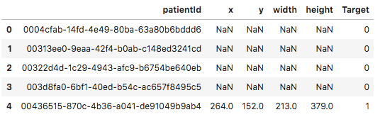 Using the fastai Data Block API. The new fastai library has made the… | by Tom McKenzie | Medium