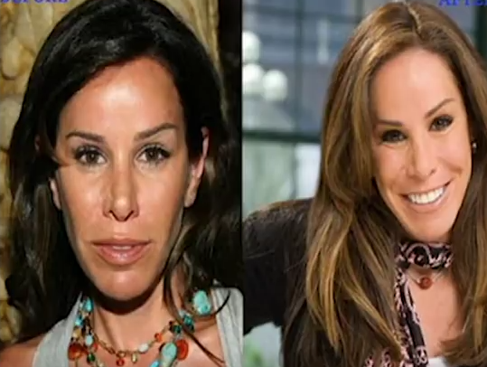 Melissa Rivers Before And After