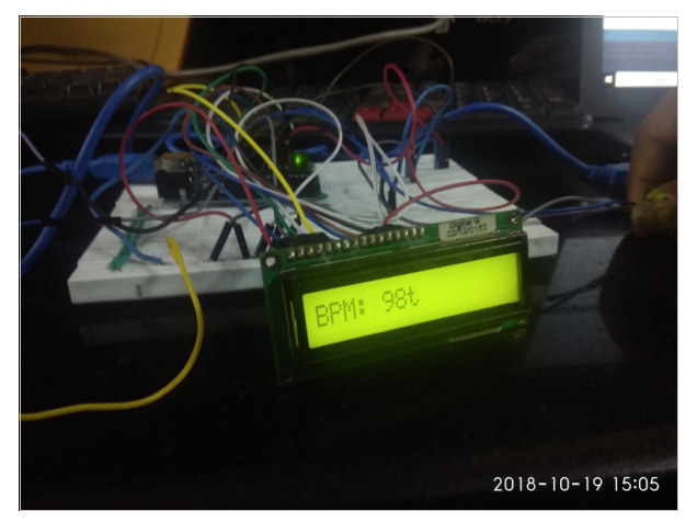 “heartbeat And Body Temperature Monitoring Using Arduino” By Mahima