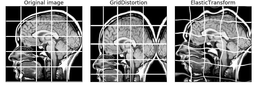Complete Guide to Data Augmentation for Computer Vision | by Olga ...