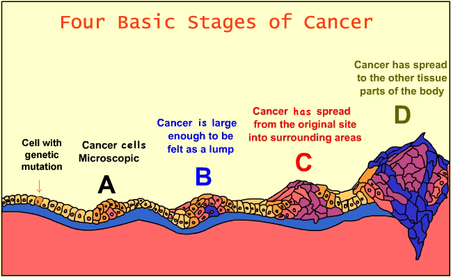 Cancer — Its Forms and Symptoms. In the United States, an estimated 15. ...