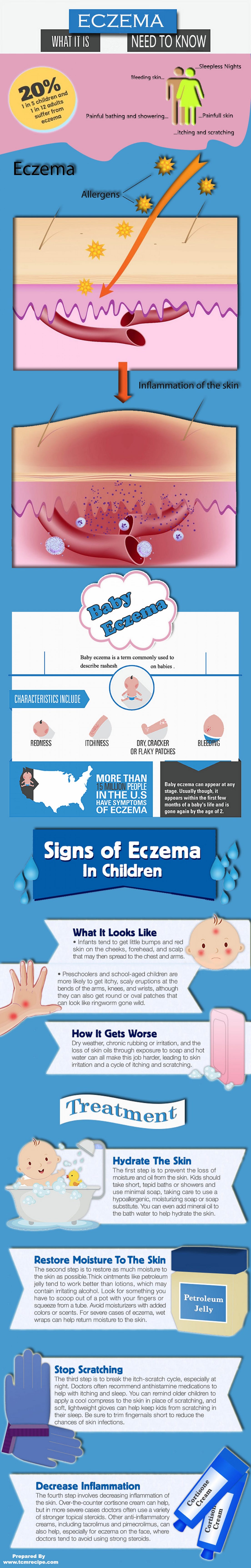 Eczema Infographics — You Must Read To Stop The Suffering From Eczema ...