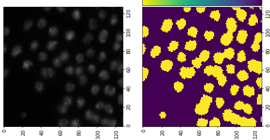 Detect Nuclei- Semantic Segmentation | by Abhishek Mishra | Medium