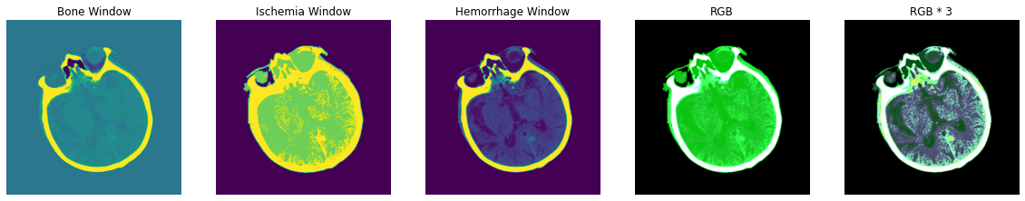 Medical Image Pre-Processing with Python | by Esma Sert | Towards Data ...