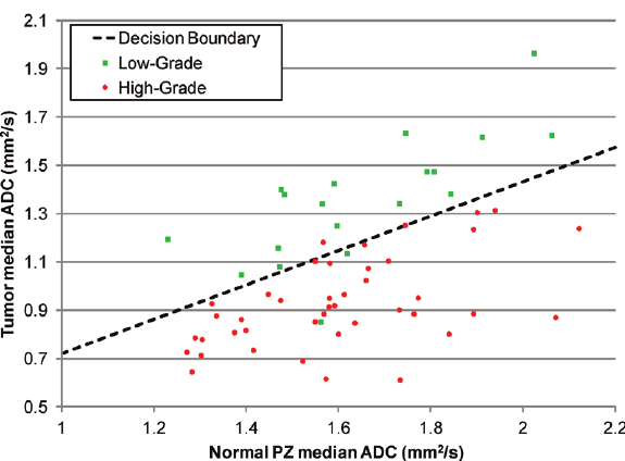 Logistics regression in 5 minutes (1/3) | by Shaun Enslin | Nerd For ...