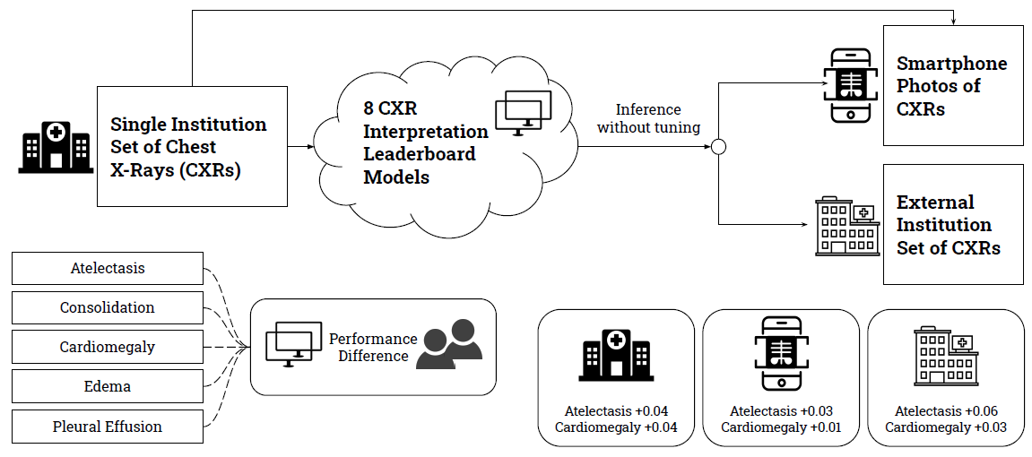 Brief Review — Chexternal Generalization Of Deep Learning Models For Chest X Ray Interpretation