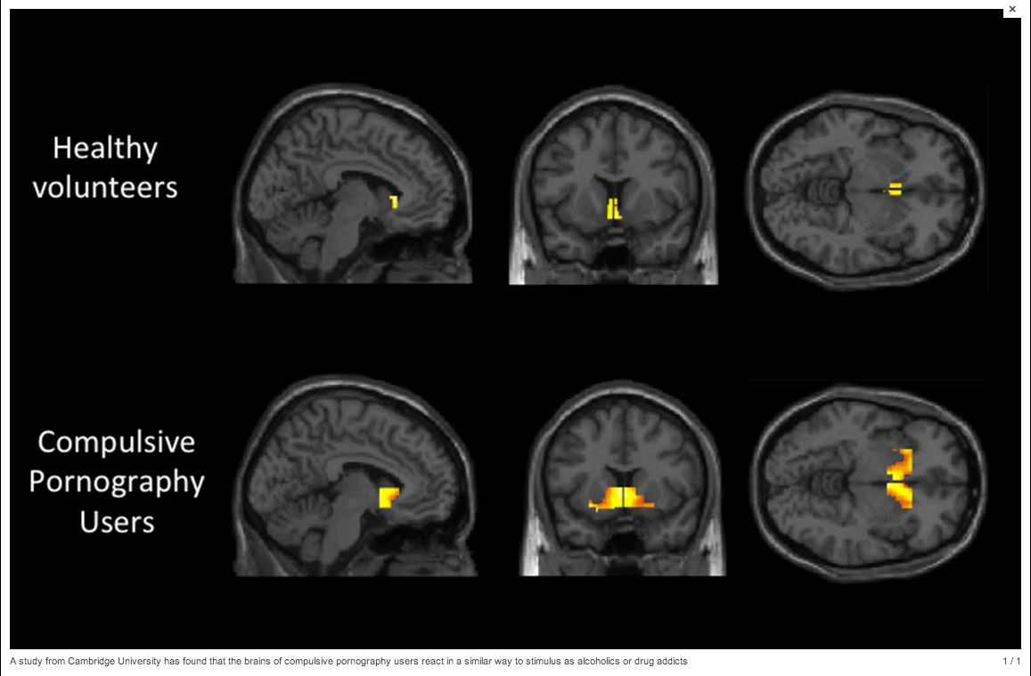 Pornography Addiction A Neuroscience Perspective By Editor [the