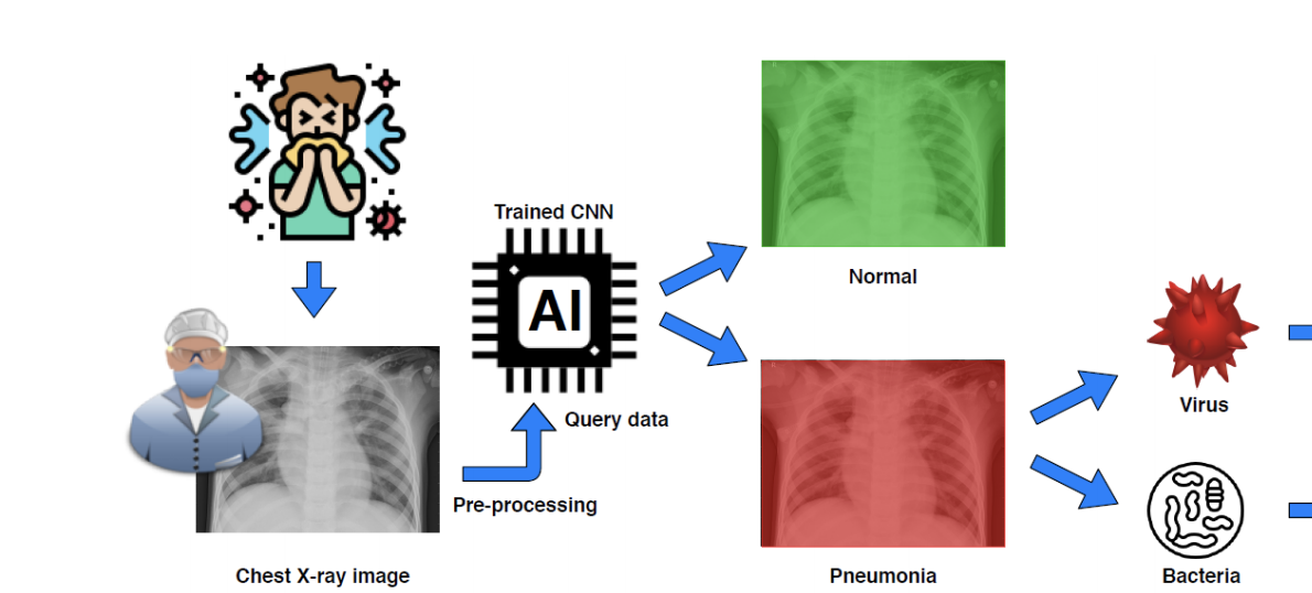 Pneumonia Diagnosis Using Deep Learning Techniques | by Khulood Nasher ...