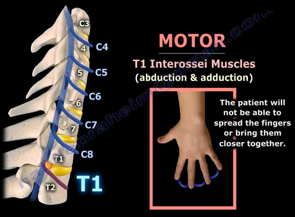 Neck Pain, Cervical Disc Herniation, & Cervical Radiculopathy | by ...