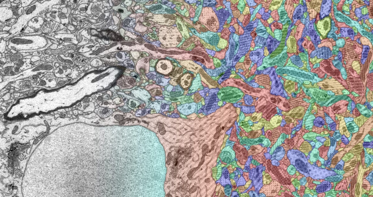 Automated Neuron Reconstruction. Creating a fully automated neuron… | by Tom Herold ...