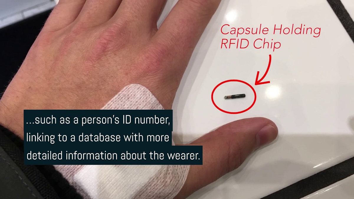 The Fears of Human Microchipping. When hearing about human ...