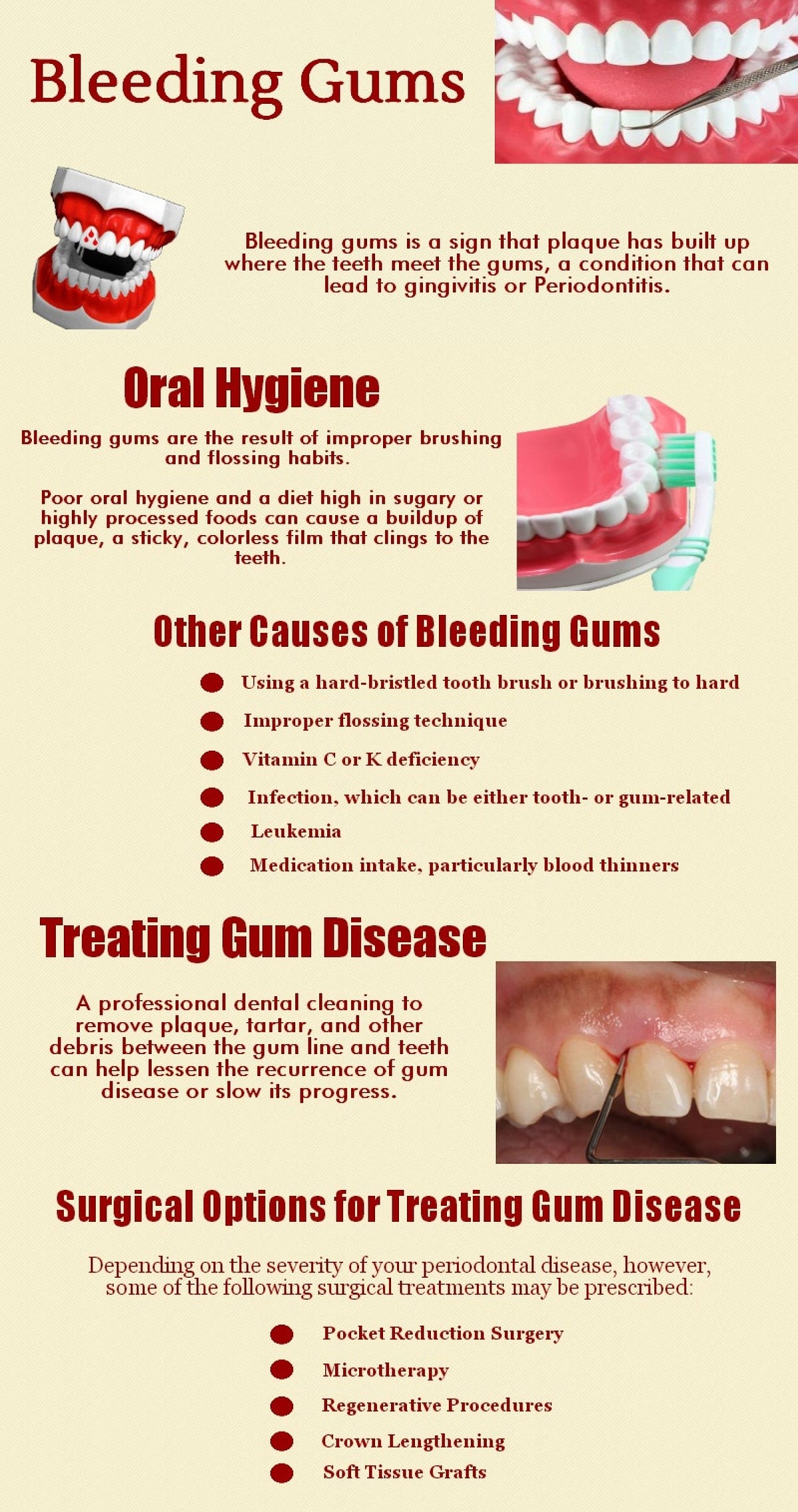 Steps for helping you with Bleeding Gums | by Tatum Brady | Medium