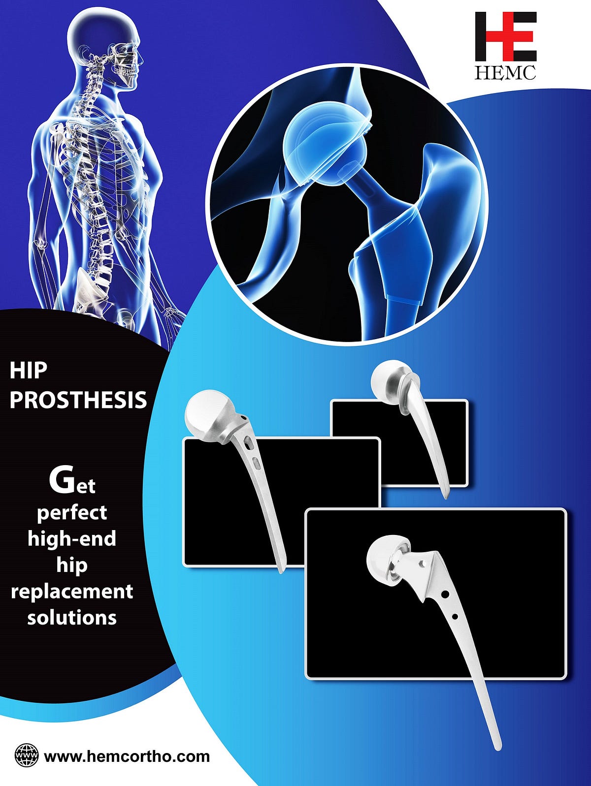 Hip prosthesis India — Get perfect high-end hip replacement solutions ...