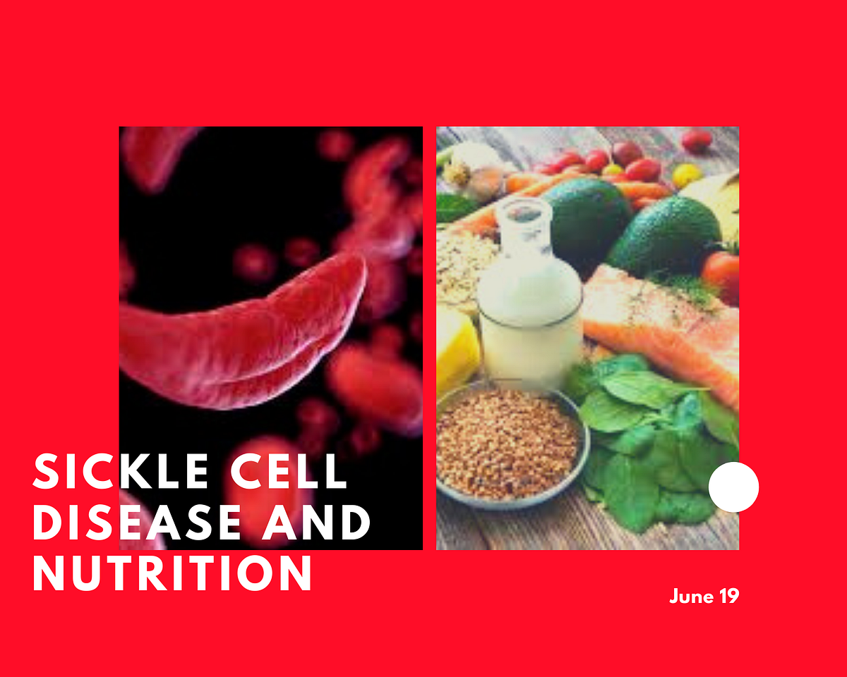 How sickle cell disease is a nutrition related disease. | by ...