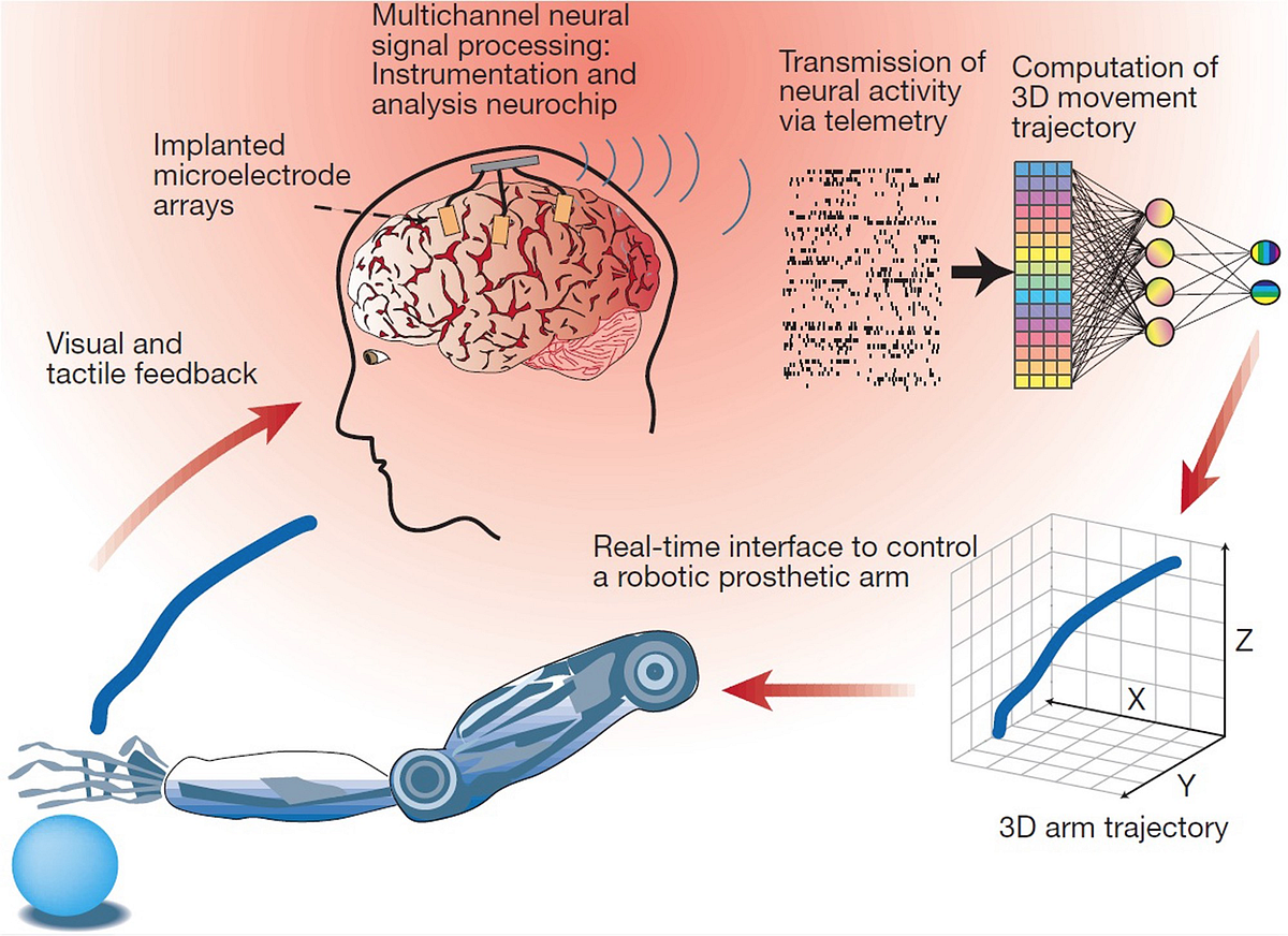 [번역] BCI(Brain Computer Interface)가 인간 행동을 대체할 수 있다. | by 이영규 | Medium