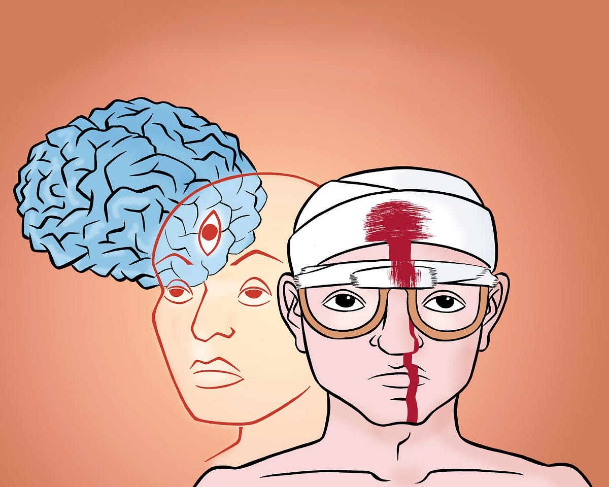 Trepanation: Elective Surgery You Need Like A Hole in the Head | by emi ...