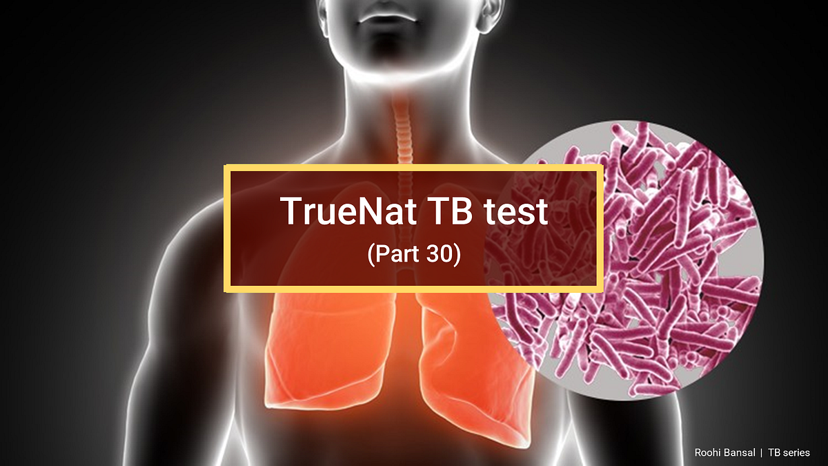 TrueNat TB test (Part 30). Welcome to the 30th part of the… | by Roohi ...
