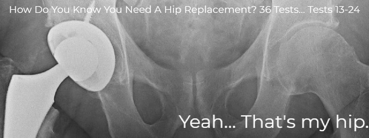How Do You Know You Need A Hip Replacement? 36 Tests… Tests 13–24 | by ...