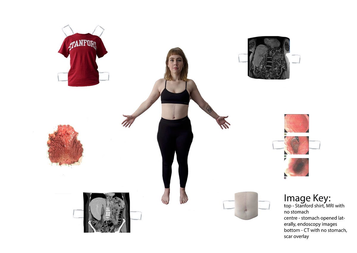 Mapping the Body Without Organ. NOTE: This essay was originally written ...