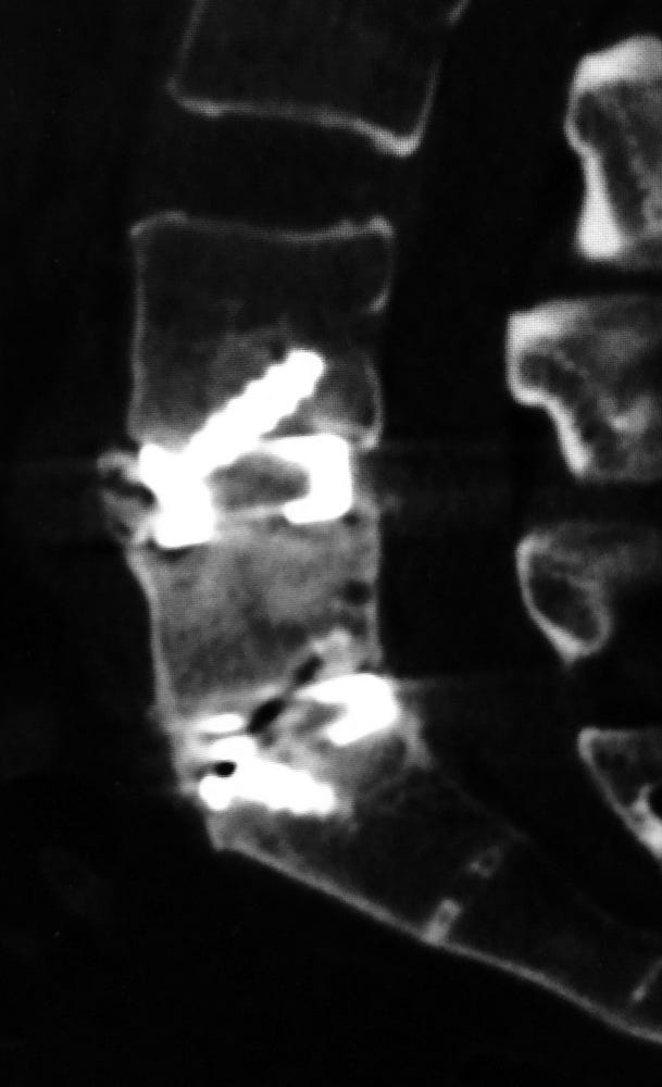 To Boldly Go . .. As A Spine Surgeon, One Of The Best… | by Daniel ...