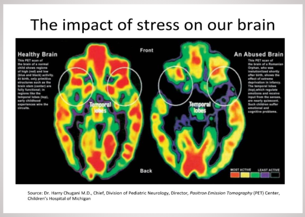 Three simple ways to mitigate stress and practice self-care | by ...