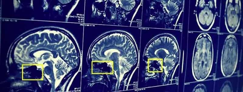 Applications of Computer Vision in AI for Various Key Industries ...