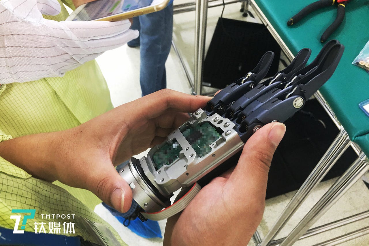 My Evolution over 29 Years with Prosthetic Hands | by TMTPOST | Medium