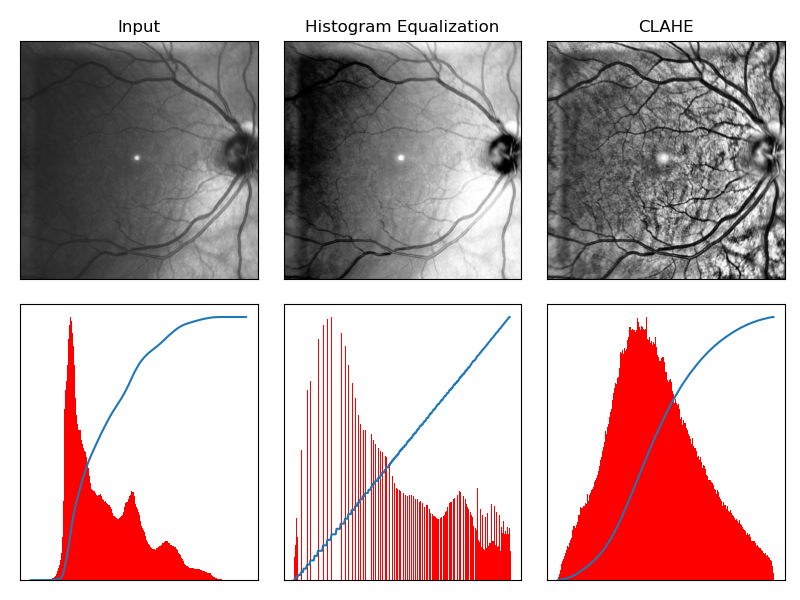 A Quick Overview of Contrast Enhancement and Its Variants for Medical Image Processing | by ...
