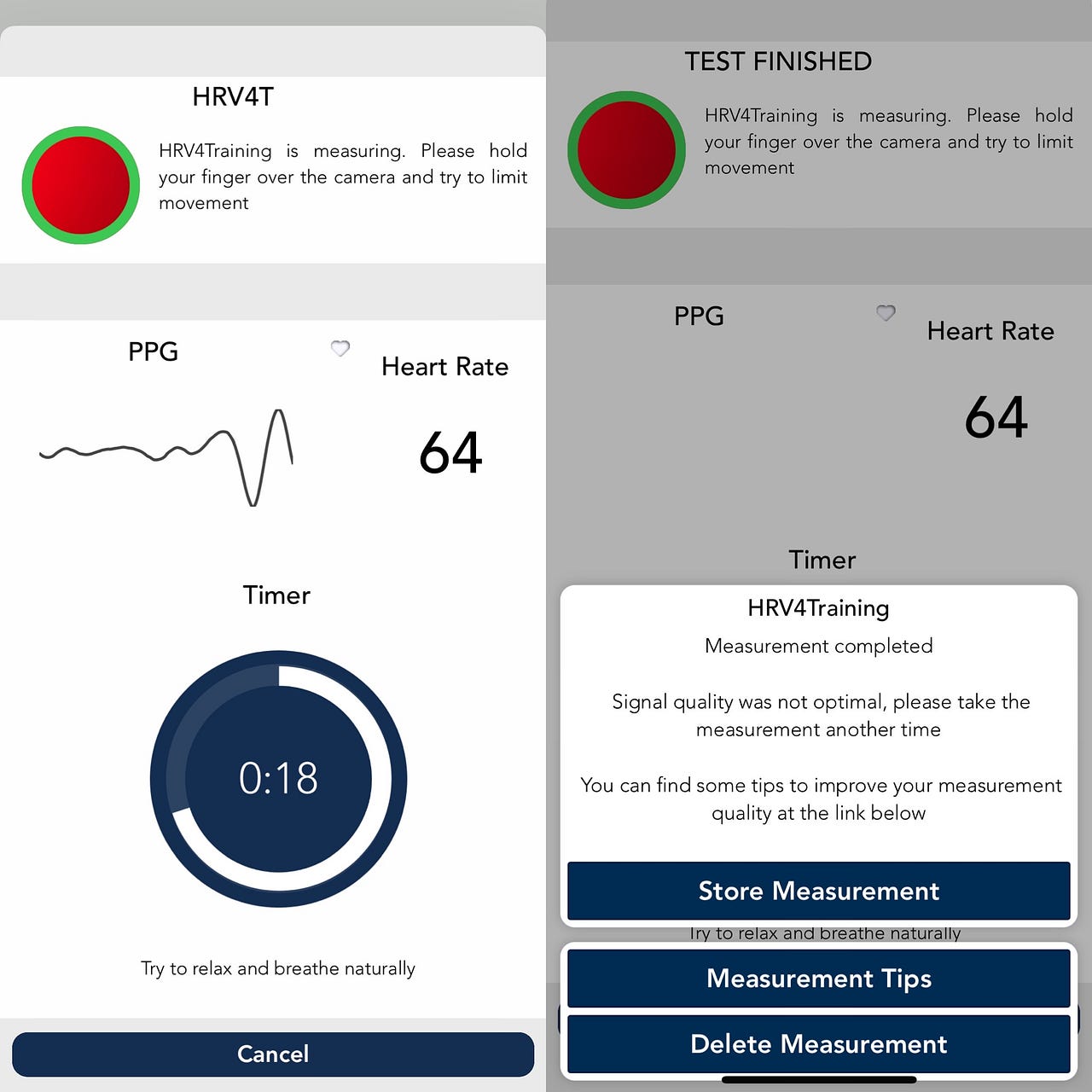 Artifact Removal for PPG-Based Heart Rate Variability (HRV) Analysis ...