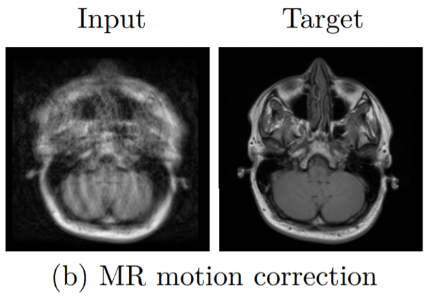 Medical Imaging being Transformed with GAN: MRI to CT Scan and many ...