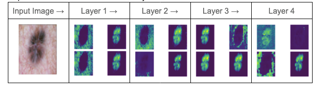 Convolutional Neural Network for Skin Cancer Classification | by Avery ...