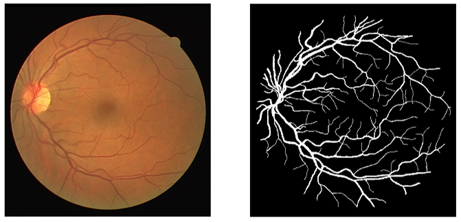 Retina Blood Vessel Segmentation using MATLAB | by Gautam Kumar | Medium